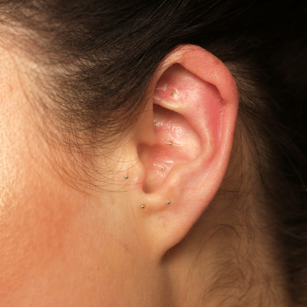 What are EarSeeds – Ear Seeds Products