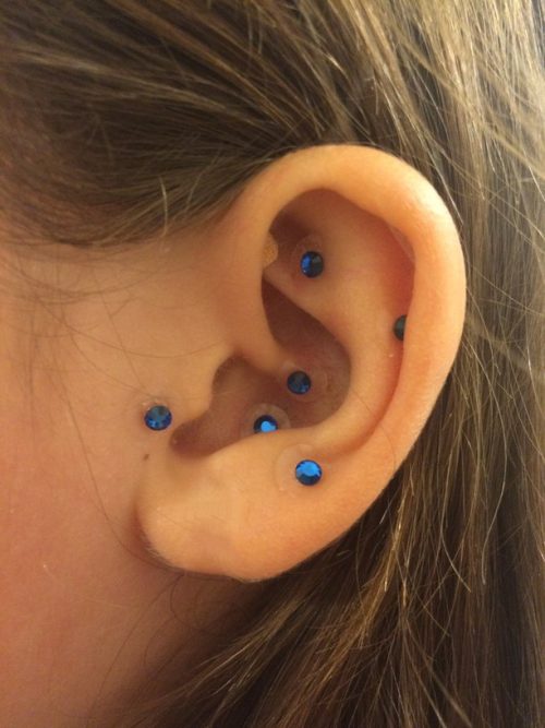 I Tried Ear Seeds on my 8 Year Old Daughter this Week and the Results ...