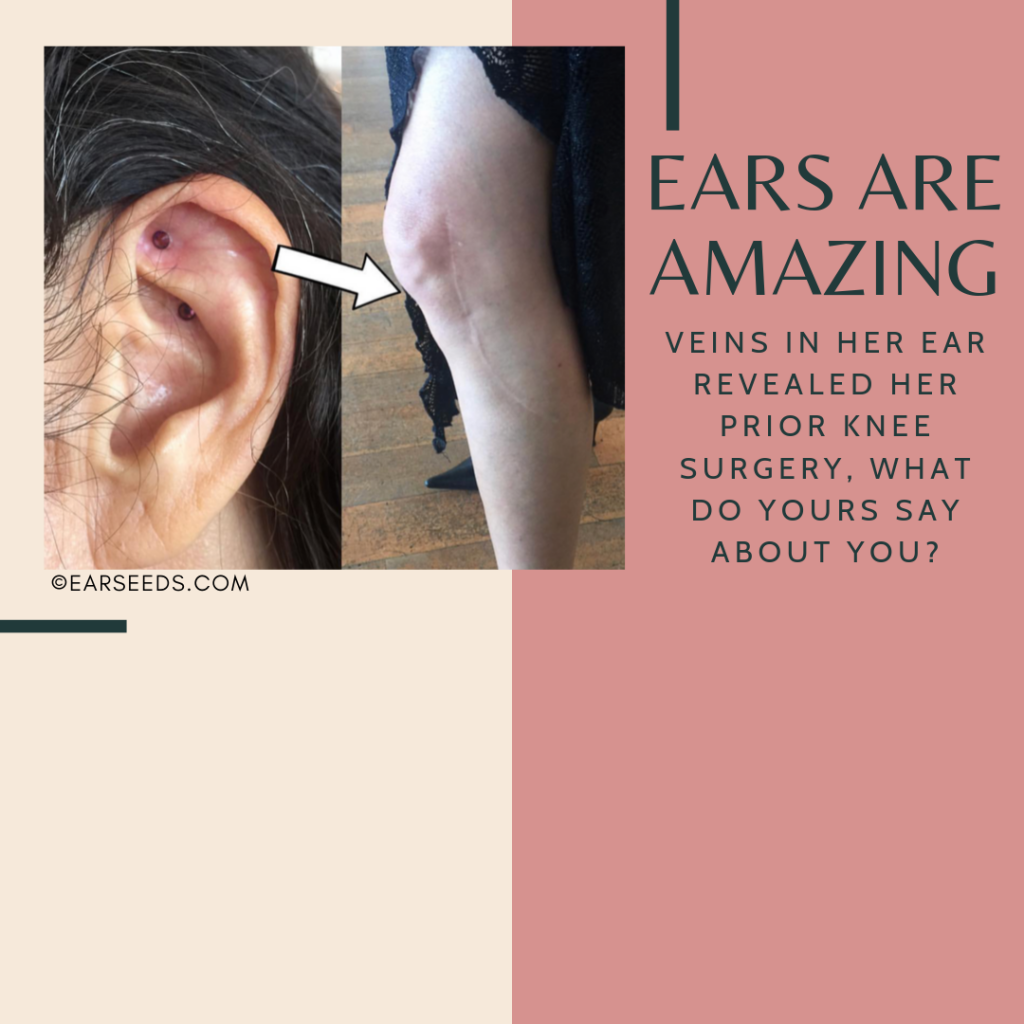 ears amazing – Ear Seeds Products
