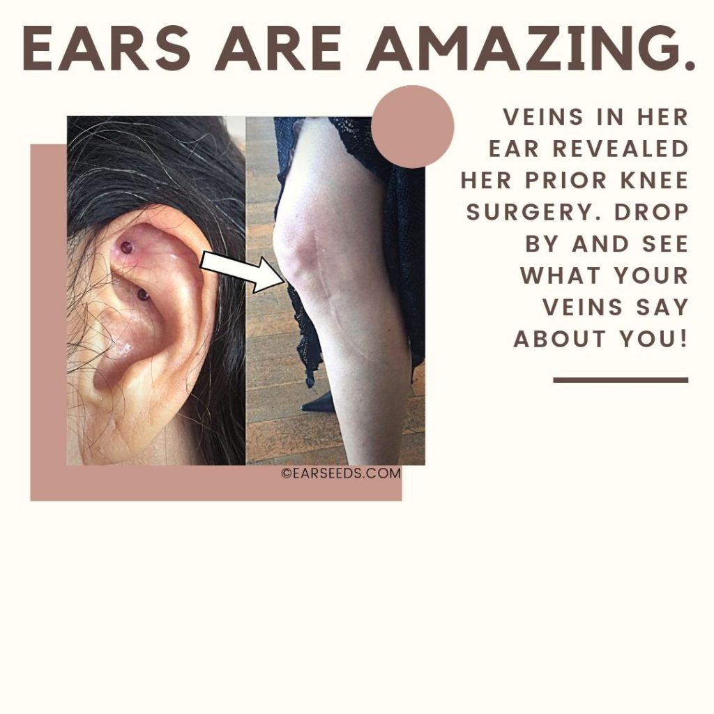 ears are amazing – Ear Seeds Products